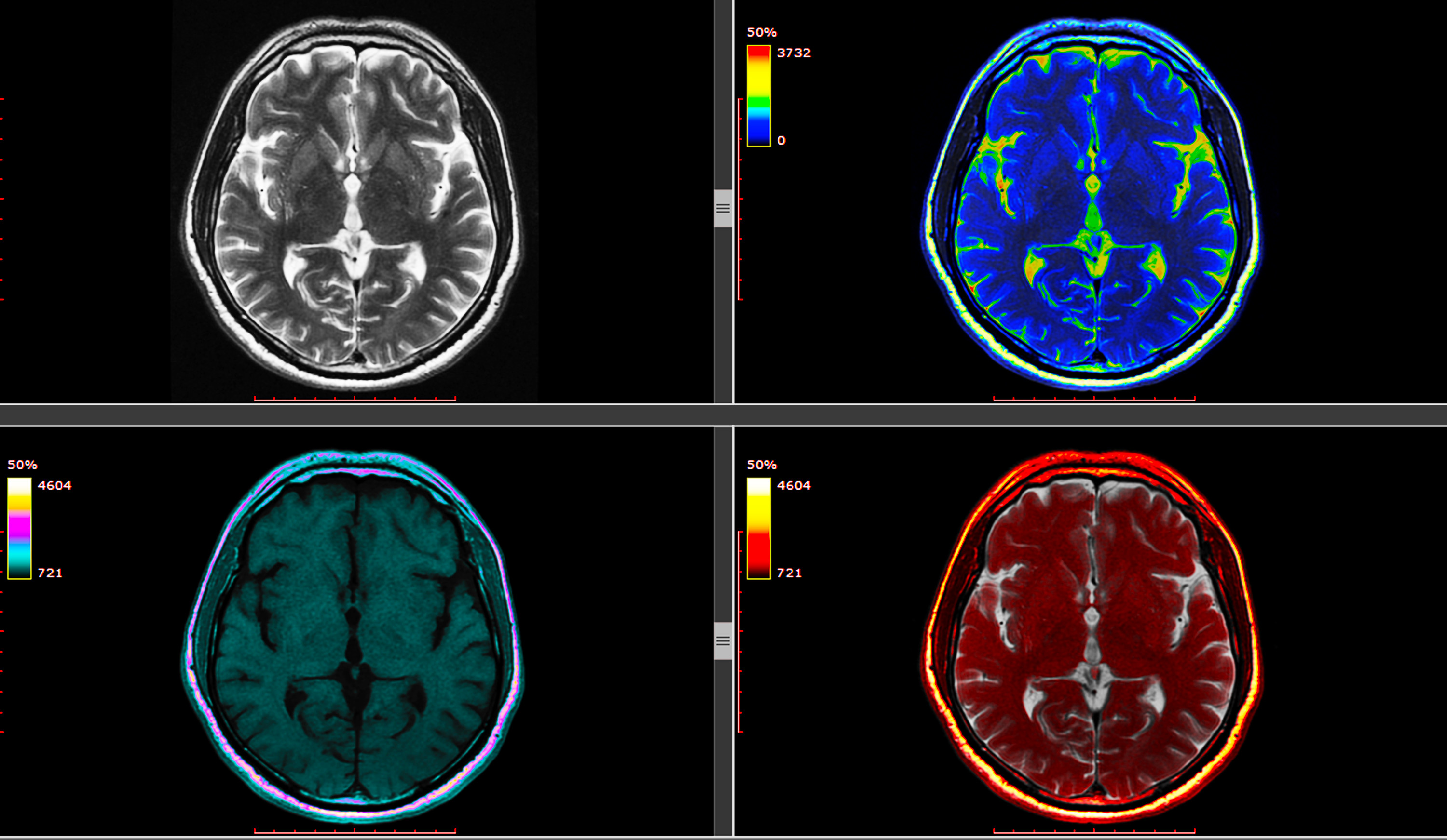 Decision Making Brain
