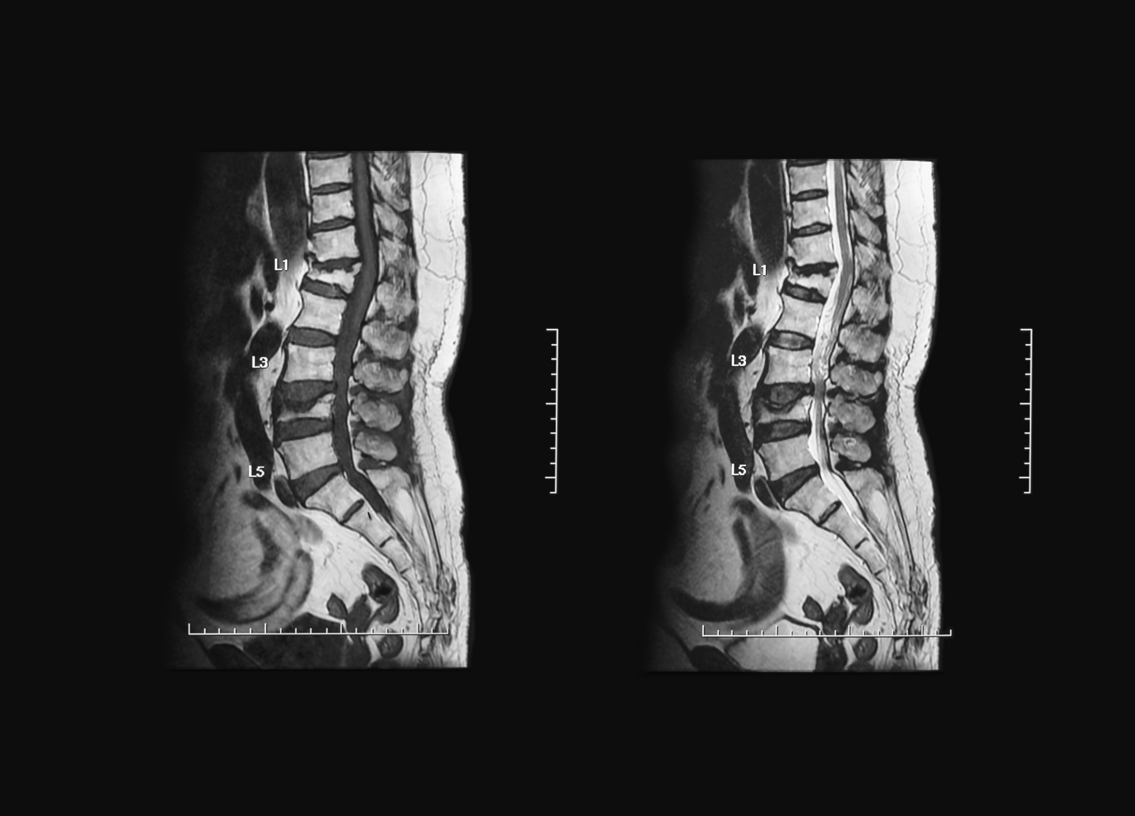 What Is MRI Contrast GE Healthcare United States What Is MRI Contrast GE Healthcare United States